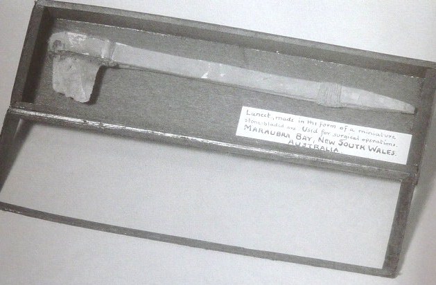 Miniature axe for surgical operations from Maroubra | A History of ...